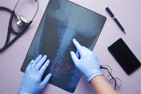 Valparaiso Bone Fracture Lawyer Lerner And Rowe Injury Attorneys