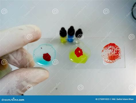 Blood Group Testing By Slide Agglutination Method Blood Grouping Stock