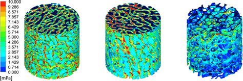 Contour Plot Of Shear Stress On The Neck Medial Condyle And Lateral