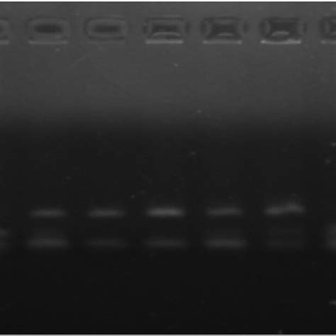 Restriction Fragment Length Polymorphism Gel Picture Of Pon1 Q192r Gene Download Scientific