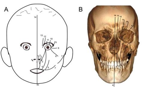 Imaging Techniques For Patients With Cleft Lip Andor Palate