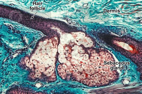 Man Sebaceous Gland Vertical Section 125x Sebaceous Gland Mammals Integumentary System
