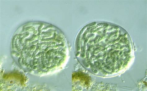 Prokaryote Nostocales Nostoc