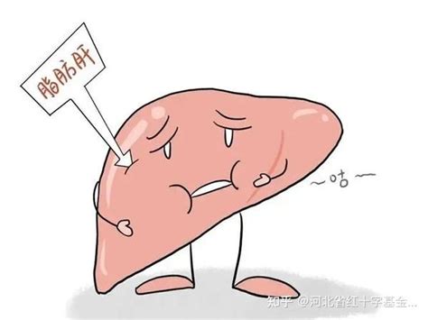 乙肝合并脂肪肝危害大怎么有效预防 知乎