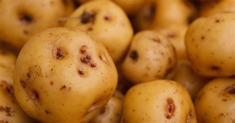 Lo Que Debes Saber Si Eres Amante De Las Papas Mundo Sano Noticias