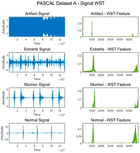 applied sciences free full text heart sound classification using