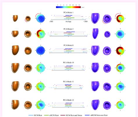 Hcmr Statistical Shape Analysis Most Relevant Pca Modes Of Variation