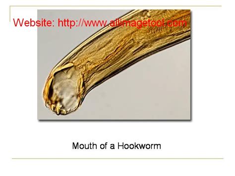 Drmoins Blog Ancylostomiasis