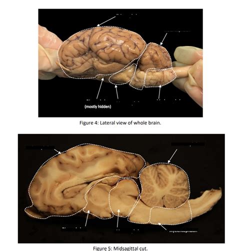 Brain 2 5 Major Divisions Of The Brain Diagram Quizlet