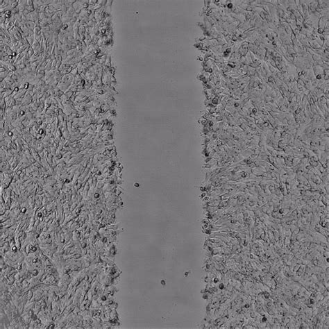Scratch Assay Post Acquisition