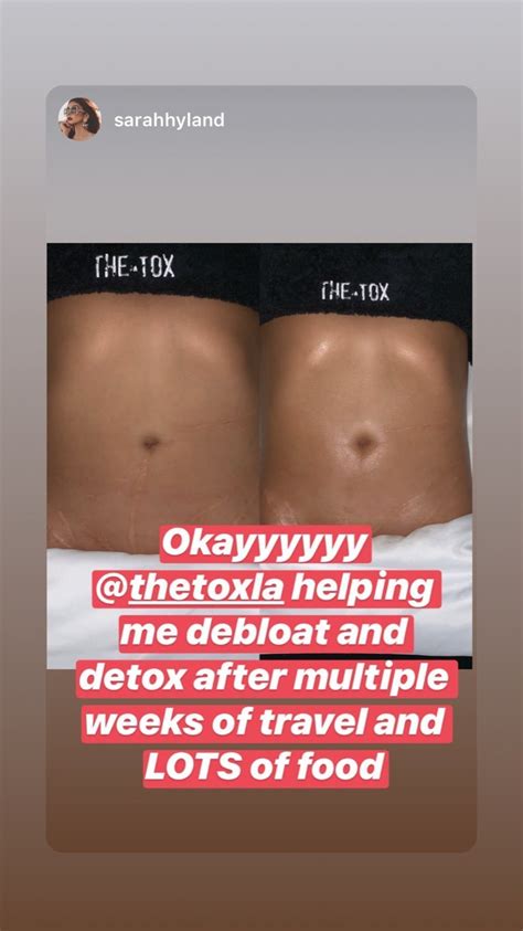 I Tried Hailey Bieber And Cara Delevingnes Go To Anti Bloat Treatment
