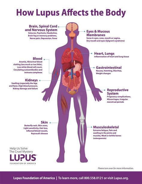 The Effects Of Lupus On The Body Artofit
