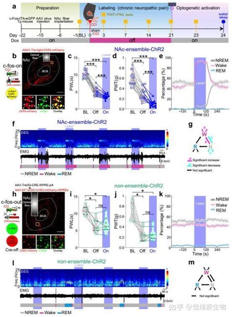 病毒示踪神经环路结合光遗传研究发现——疼痛和睡眠障碍具有相同的伏隔核神经调控机制 知乎