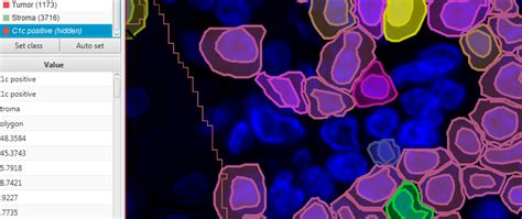 Qupath Multiplex Classifier Image Analysis Imagesc Forum