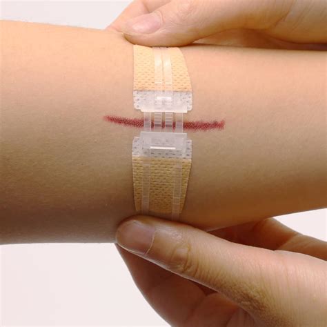 Longmed Emergency Wound Closures Butterfly Adhesive Bandages 3