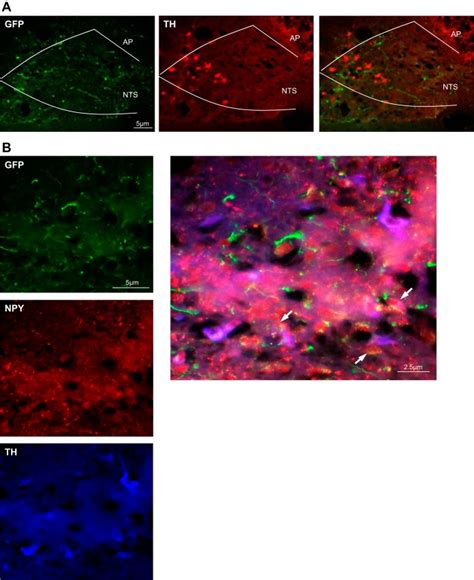 Dorsomedial Hypothalamic NPY Affects Cholecystokinin Induced Satiety Via Modulation Of Brain