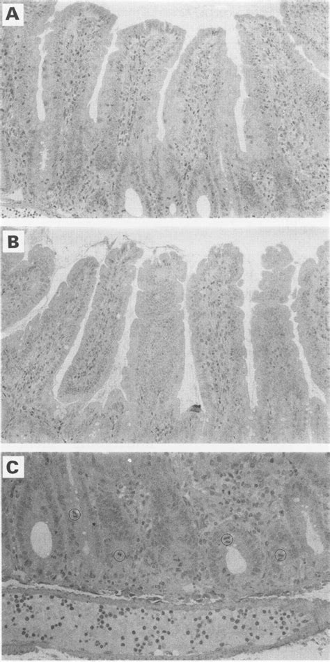 Low Power Light Micrographs Representative Of The Terminal Ileum Of The
