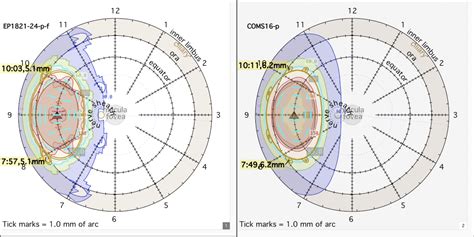 Dose Histogram Window
