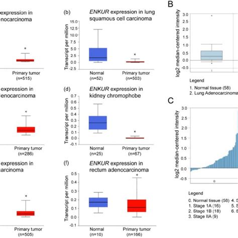 Ualcan And Oncomine Analyses Of Enkur In Lad A Expression Profiling Download Scientific