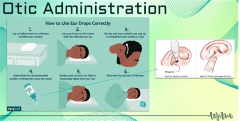 313 Disorders And Prototype Drugs Sensory Flashcards Quizlet