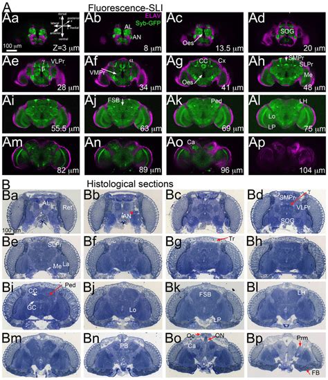 Dissection Drosophila Brain At Teresa Huffman Blog