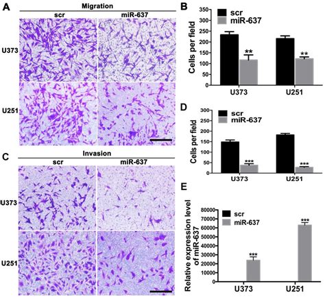 Mir 637 Inhibits The Migration And Invasion Of Glioma Cell Lines A