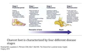 Charcot Neuroarthropathy In Orthopaedics Pptx