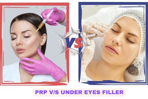 Prp Vs Fillers For Under Eyes Clinic Next Face