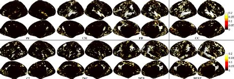 Figure 3 From How Does The Brain Process Syntactic Structure While
