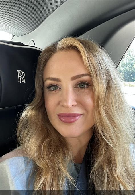 I Want To Share With You My Journey With Alopeciaareata Over The Past
