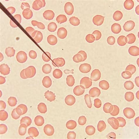 Xylene Substitute Rhistology