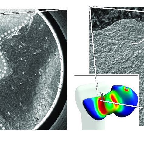 Sem Micrographs Of Fracture Patterns Relating To Calculated Stresses