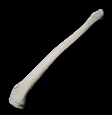 Human Tibia Paxton Gate