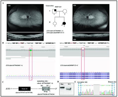 Clinical And Functional Validation Of Intronic Splicing Variant Of Chm