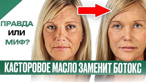 Касторовое масло заменит ботокс - YouTube