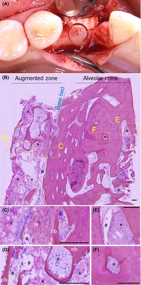 Alveolar Bone Histology Jaypeedigital Ebook Reader
