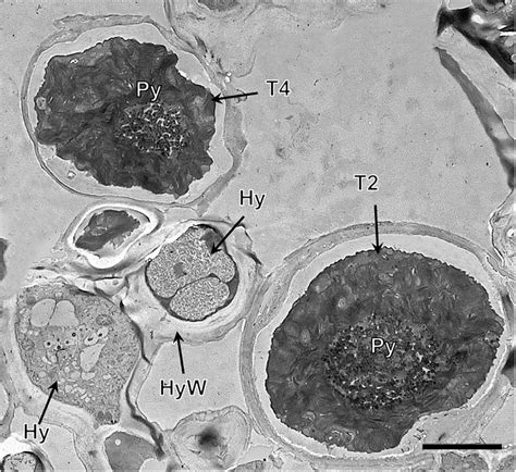 Tem Of The Trebouxia Phycobiont Lineages T2 And T4 Coexisting In