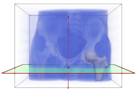 Femur Ssm Directly From Images Shapeworks