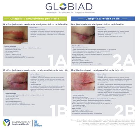 Incontinence Associated Dermatitis Iad Vs Pressure Ul Vrogue