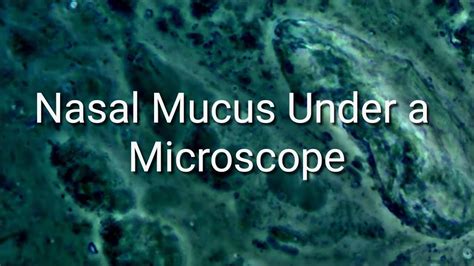 Nasal Mucus Under A Microscope Youtube