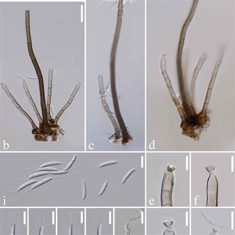 Dictyochaeta Aquatica Holotype Mflu 15 2691 A Colonies On