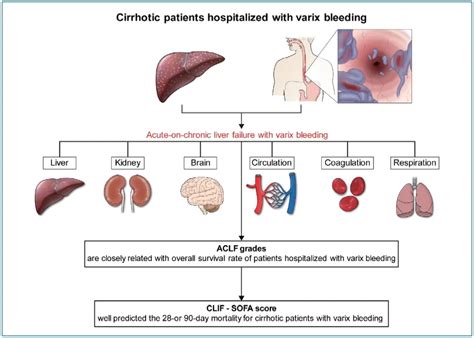 Best Aclf Specialist In Mumbai Best Aclf Specialist In South Mumbai Dr Chetan Kalal
