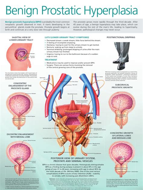 Bph Prostate Genitourinary System Diseases