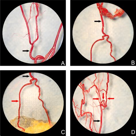 Number Of Intraosseous Artery Branches Black Arrow Indicates The