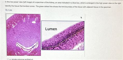In This Low Power View Left Image ﻿of A Specimen Of