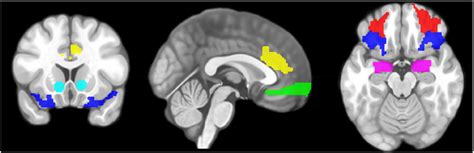 Visualization Of Rois Chosen For Analysis The Ventral Striatum Is