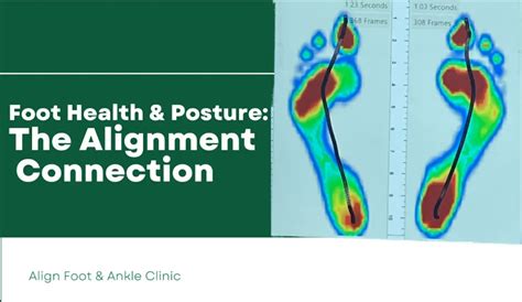 Foot Health And Posture The Alignment Connection Align Foot And Ankle
