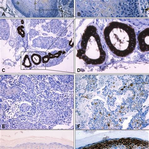 Paraffin Embedded Tissue Microarray Samples Were Subjected To Antigen Download Scientific