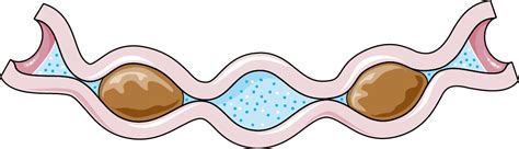 Intestine Segmentation Servier Medical Art