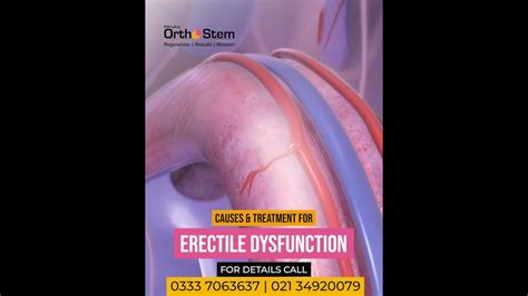 Causes And Treatment For Erectile Dysfunction Alkhaleej Orthostem Youtube